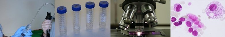 E-Learning: BAL in the work-up of ILD - ildcare